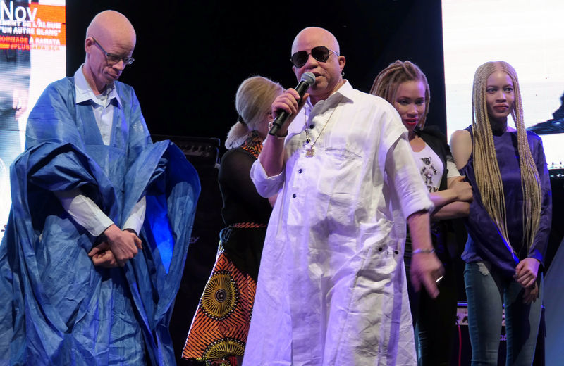 Mali singer Salif Keita highlights plight of African albinos By Reuters